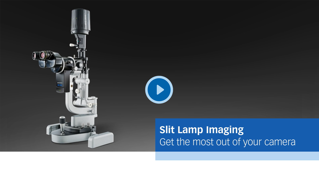 Slit lamp imaging