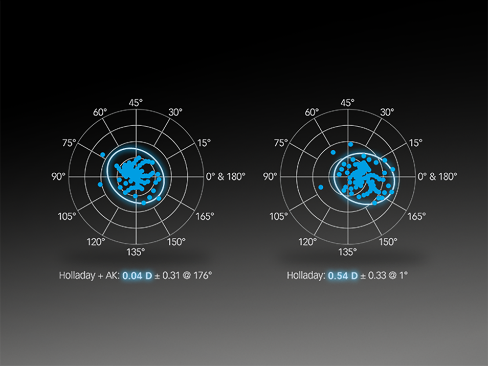 EyeSuite IOL - IOL power selection by artificial intelligence