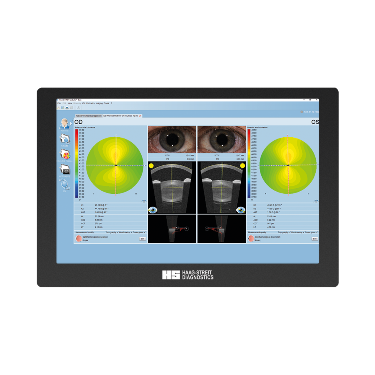 Eyestar 900 - Swept-source OCT technology