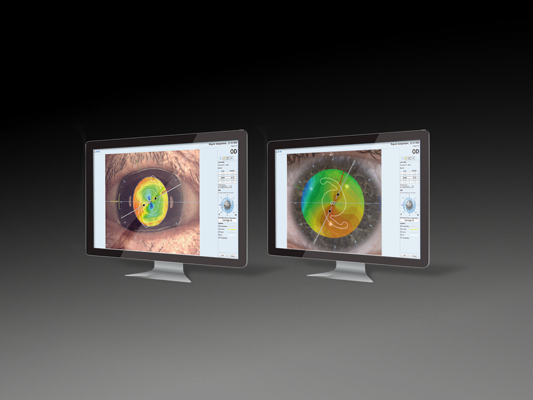 Biometry