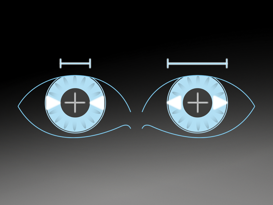 Lenstar 900 - Optical biometry