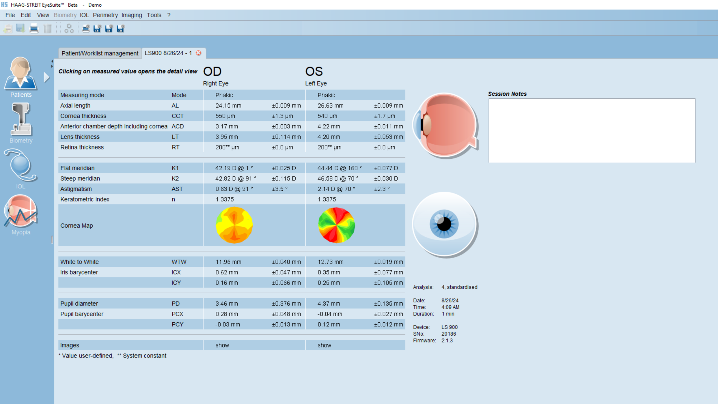 Lenstar 900 - Optical biometry