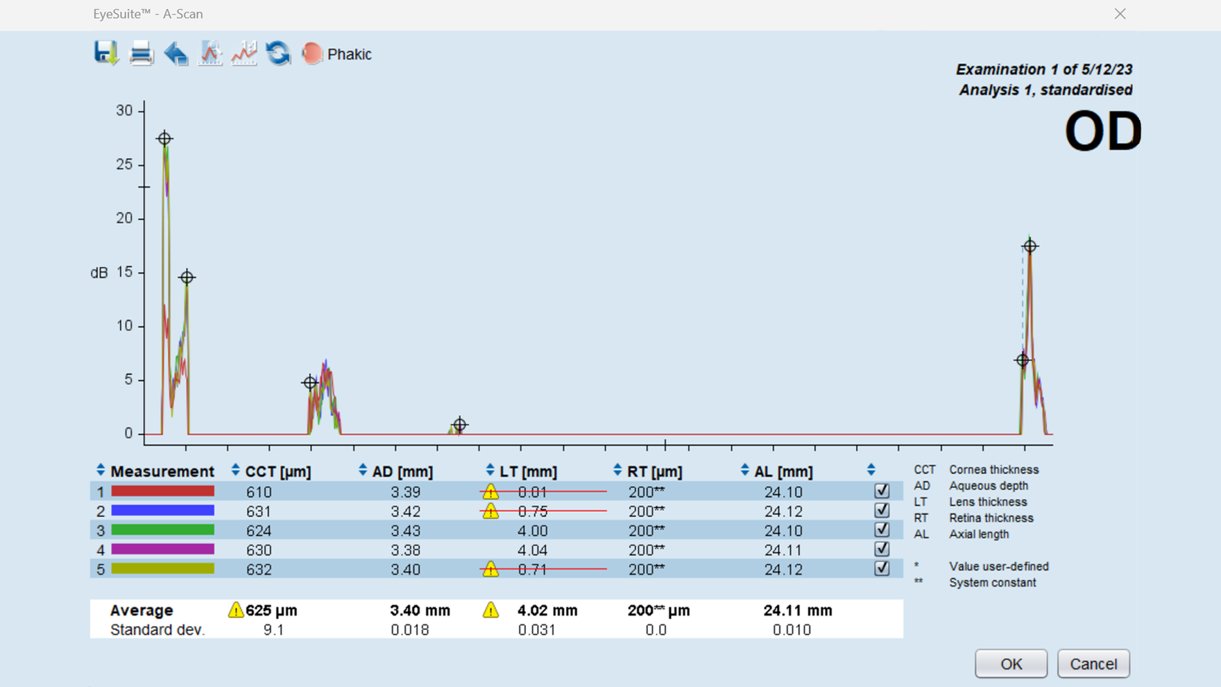 Lenstar 900 - Optical biometry