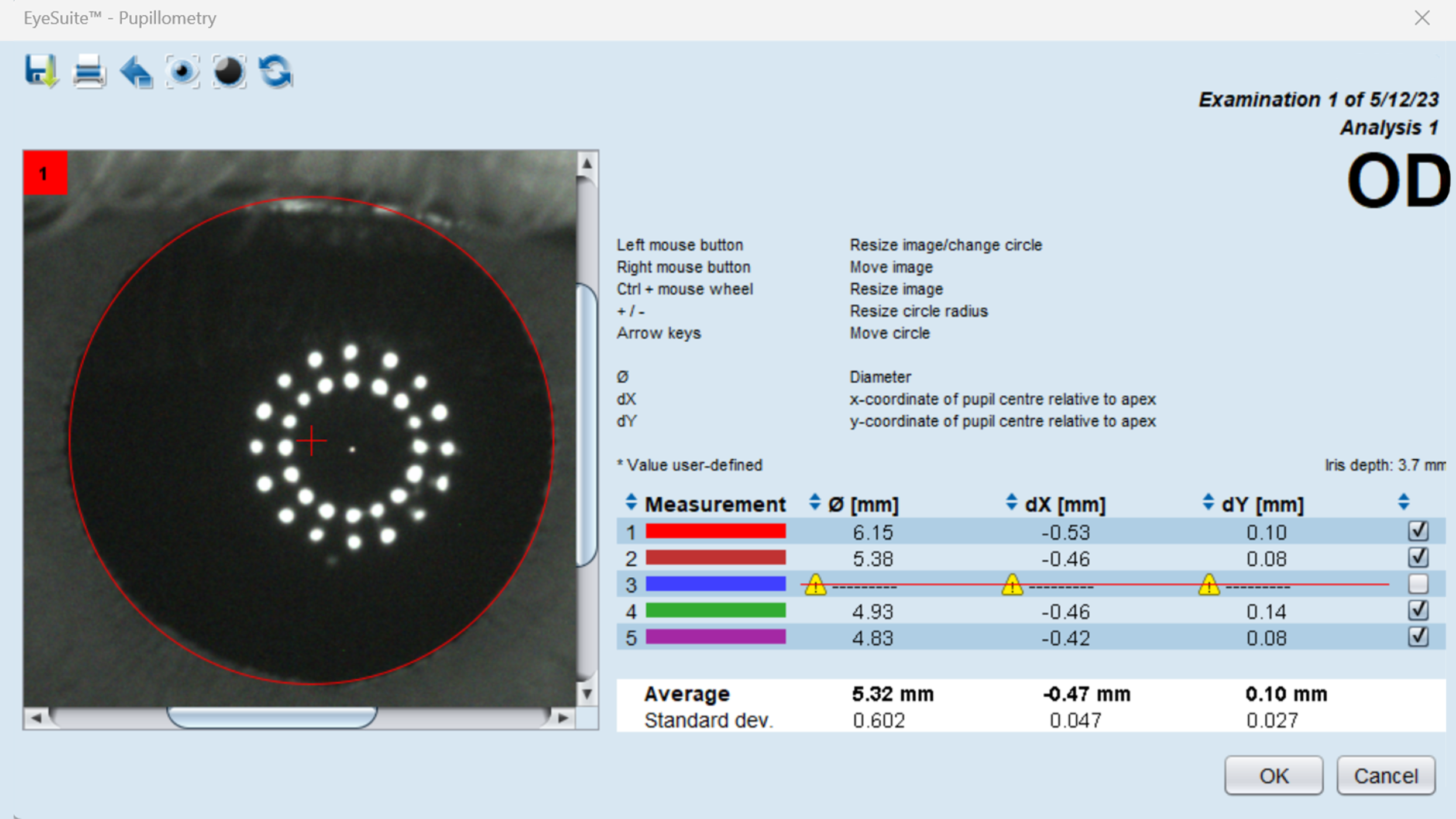Lenstar 900 - Optical biometry