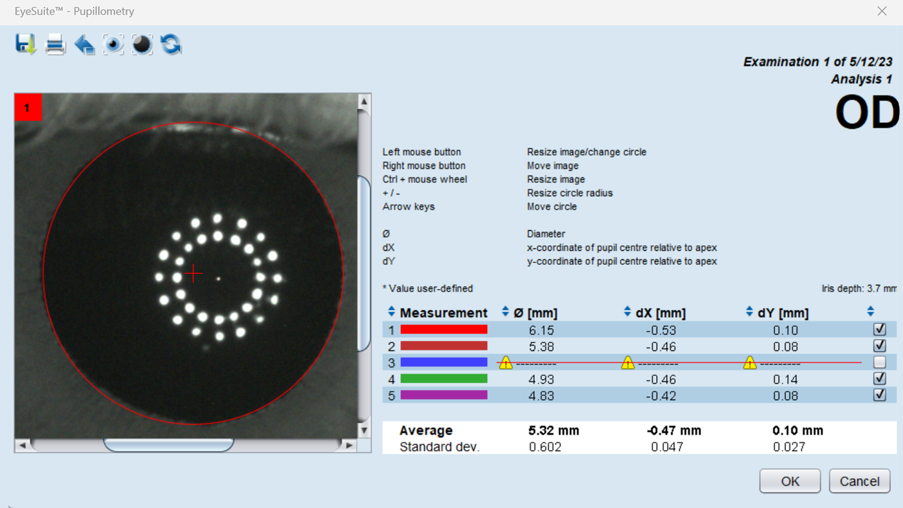 Lenstar 900 - Optical biometry