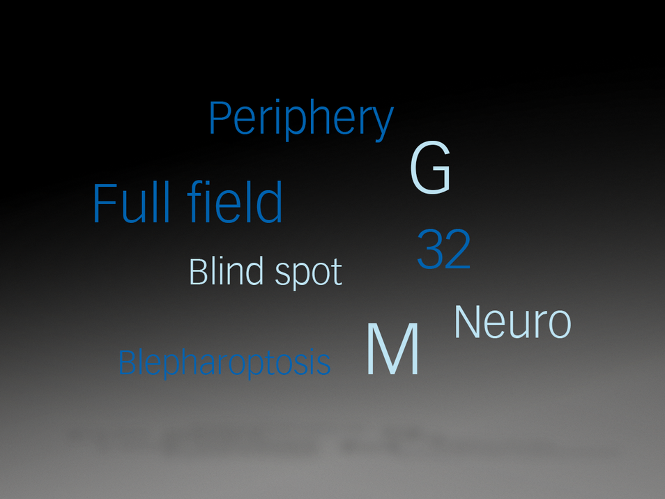 Octopus 900 - Full field static perimetry